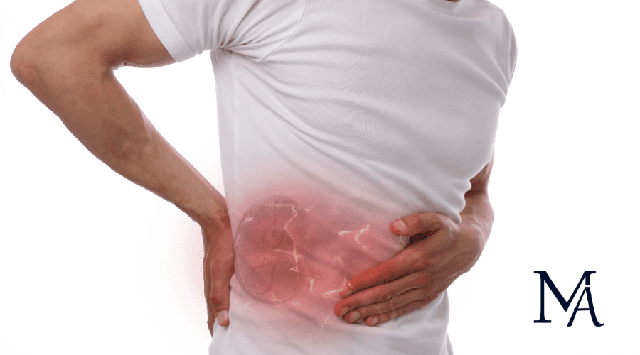 Pyéloplastie : traiter le syndrome de la jonction pyélo-urétérale