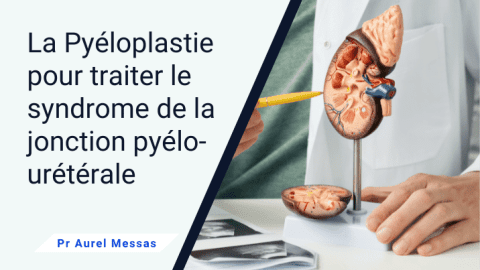 Pyéloplastie : traiter le syndrome de la jonction pyélo-urétérale
